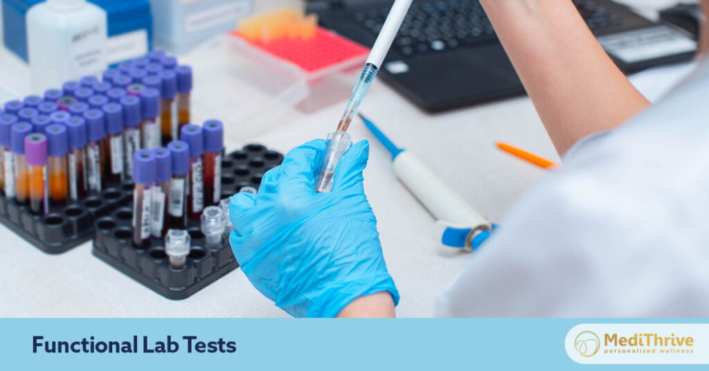 Cornelius, NC Functional Lab Tests for Lake Norman – MediThrive ...